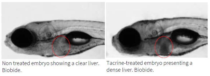 Hepatotoxicity Assay in Drug Discovery